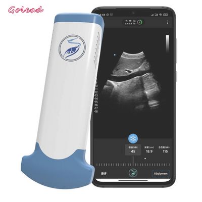 Quality Handheld Ultrasound Scanner & Wireless Ultrasound Probe factory ...